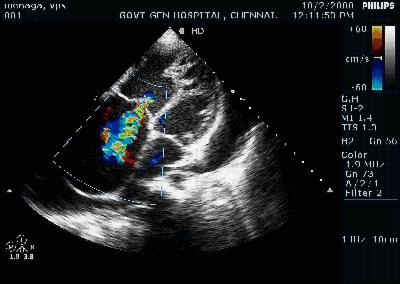 Echo GIF - Find & Share on GIPHY