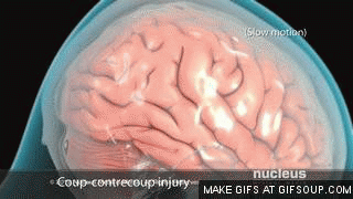 Concussion GIF - Find & Share on GIPHY