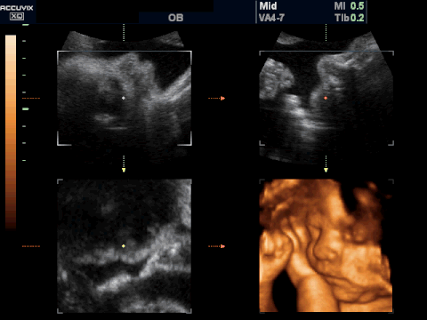 Fetus GIF - Find & Share on GIPHY