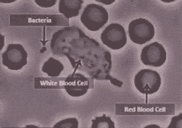 Glóbulo blanco persiguiendo a bacteria,... - Es de Científico