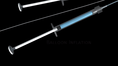 IsoFlow -The Latest in Cancer Treatment Technology | Indiegogo