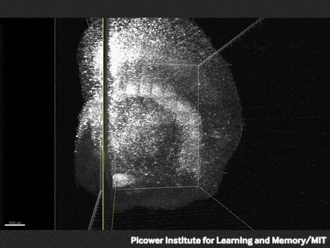 Brain Mouse GIF by Science Friday - Find & Share on GIPHY