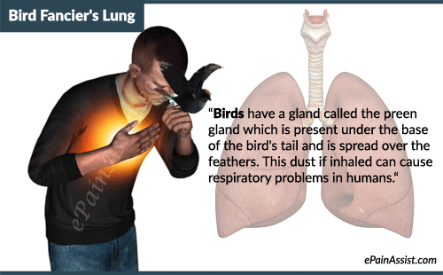 Bird Fancier'S Lung GIFs - Find & Share on GIPHY