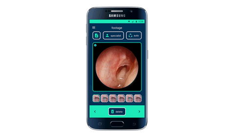 hearScope : Next generation smartphone otoscope | Indiegogo