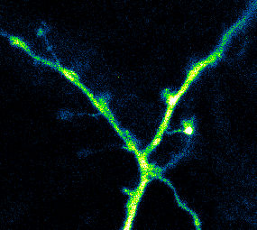 Dendrite GIFs - Get the best GIF on GIPHY