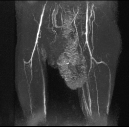 Mri GIF - Find & Share on GIPHY