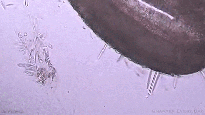 Nematocyst GIFs - Find & Share on GIPHY