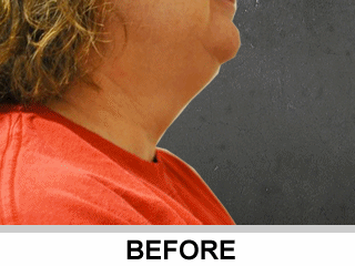 Neck GIFs - Find & Share on GIPHY