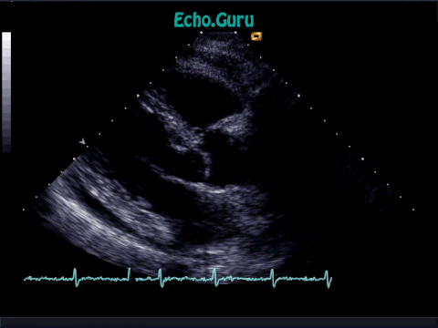 Echo GIFs - Find & Share on GIPHY