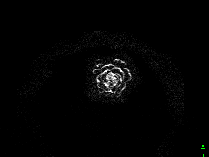 Mri GIF - Find & Share on GIPHY