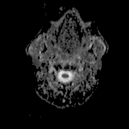 Mri GIF - Find & Share on GIPHY