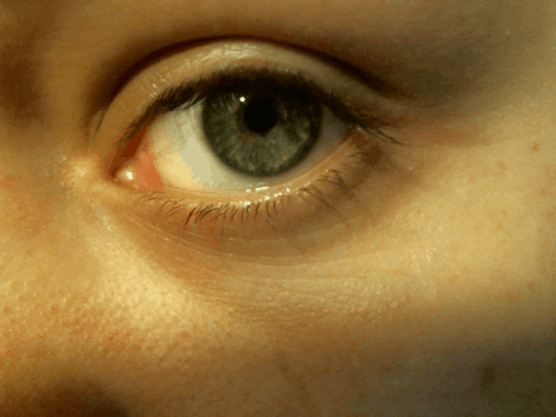 9 things you’ve had said to you if you have a lazy eye | Metro News