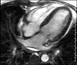 Mri GIF - Find & Share on GIPHY