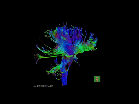 Mri GIF - Find & Share on GIPHY