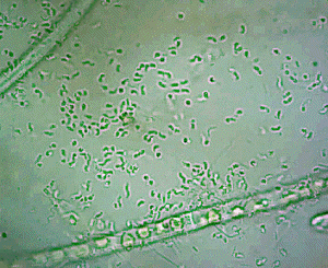 Vibrio Cholera GIFs - Find & Share on GIPHY
