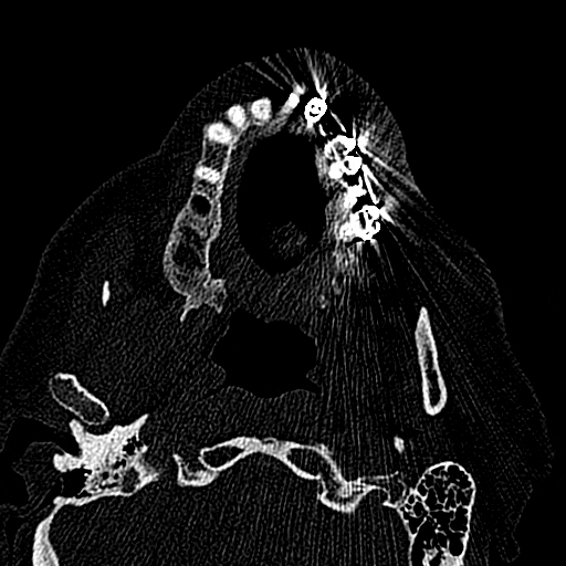 Teeth GIF - Find & Share on GIPHY