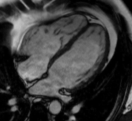 Mri GIF - Find & Share on GIPHY