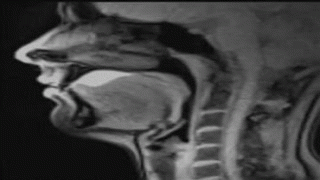 Mri GIF - Find & Share on GIPHY