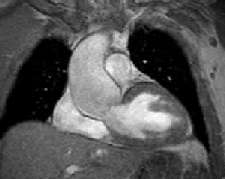 Mri GIF - Find & Share on GIPHY