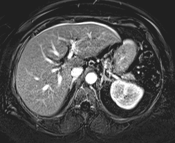 Mri GIF - Find & Share on GIPHY