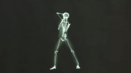 X-Ray GIFs - Find & Share on GIPHY