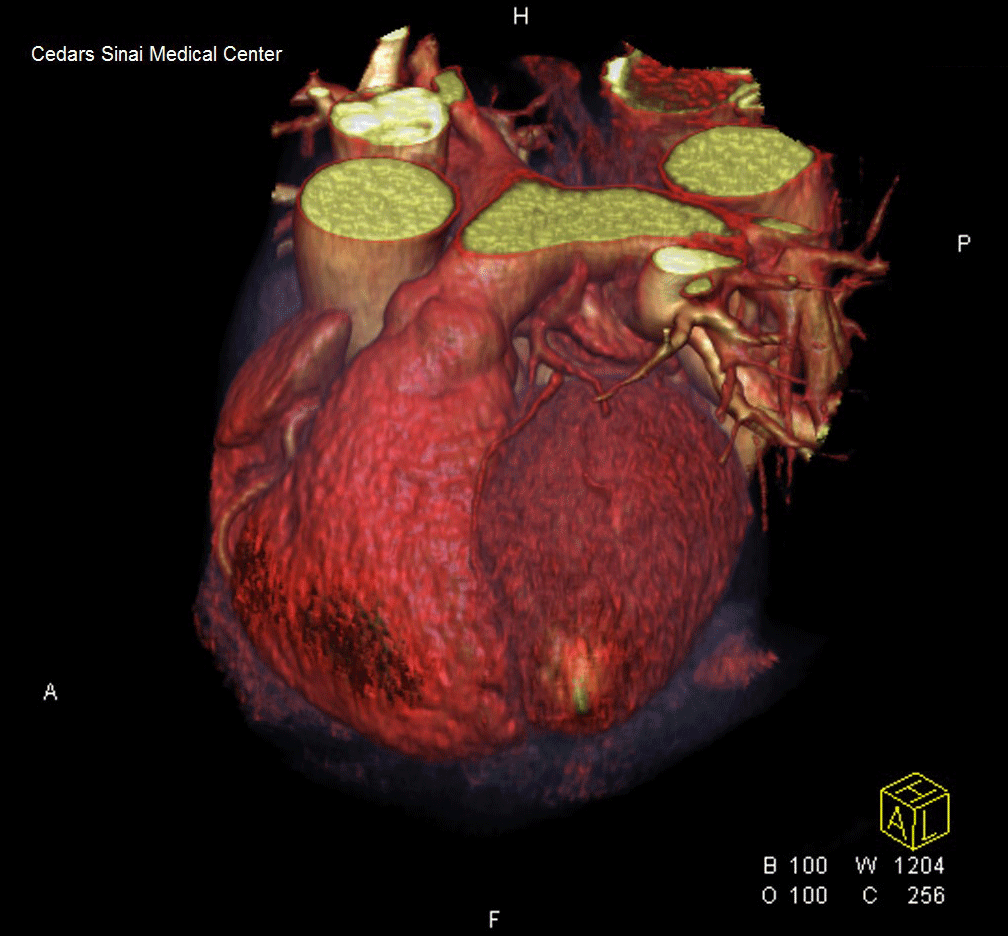 Ct GIF - Find & Share on GIPHY