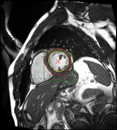 Mri GIF - Find & Share on GIPHY