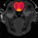 Mri GIF - Find & Share on GIPHY