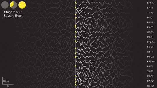 Eeg GIFs - Find & Share on GIPHY