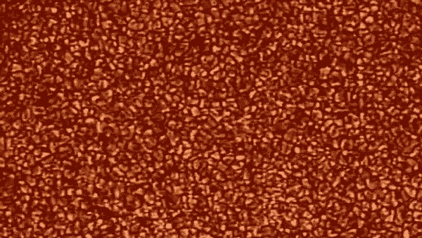 Granulation GIFs - Find & Share on GIPHY