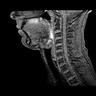 Mri GIF - Find & Share on GIPHY