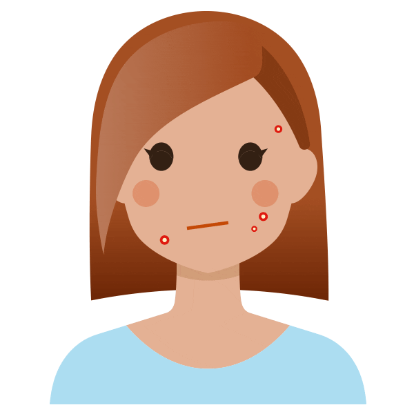 Acne Lrp Sticker by La Roche-Posay Ar for iOS & Android | GIPHY