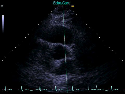 Echo GIF - Find & Share on GIPHY