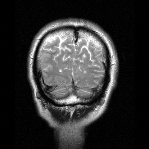 Brain GIF - Find & Share on GIPHY