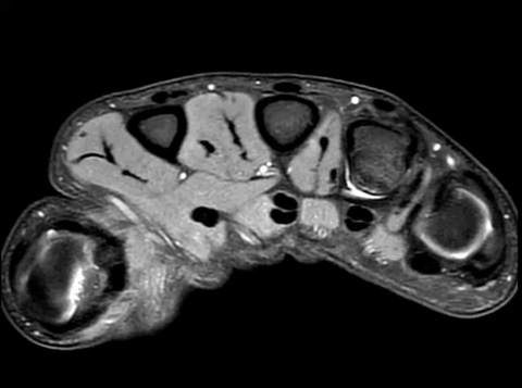 Hand Mri GIF - Find & Share on GIPHY