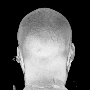 Mri T1 GIF - Find & Share on GIPHY