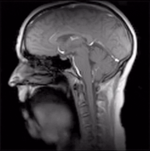 Dynamic Mri GIF - Find & Share on GIPHY