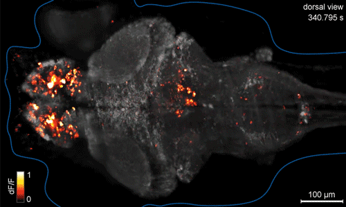 Brain GIF - Find & Share on GIPHY