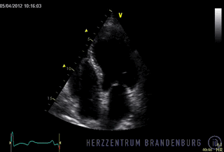 Heart Failure GIFs - Get the best GIF on GIPHY