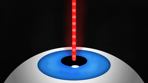 Laser Eye Surgery GIFs - Get the best GIF on GIPHY