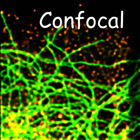 Microscopy GIF - Find & Share on GIPHY