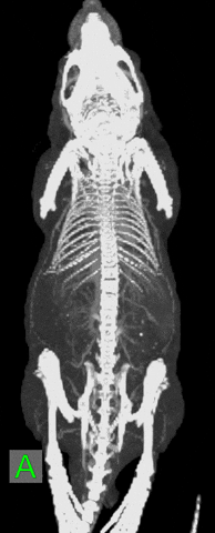 Ct Xray GIF by TriFoil Imaging - Find & Share on GIPHY