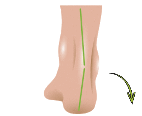 Feet Foot Sticker by Clinisalud for iOS & Android | GIPHY