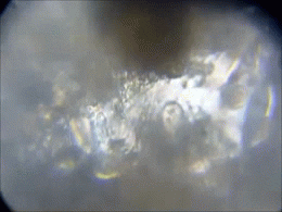 Bacteria Microscope GIF - Find & Share on GIPHY