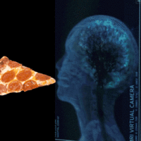 Mri GIF - Find & Share on GIPHY