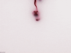 Bleeding GIF - Find & Share on GIPHY