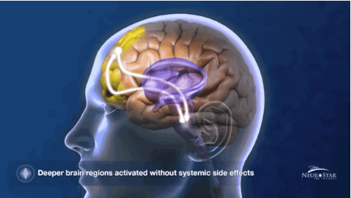 Brain GIF - Find & Share on GIPHY