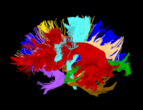 Brain Connectivity GIF - Find & Share on GIPHY