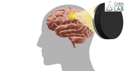 Research Brain Cancer GIF by Washington University in St. Louis - Find ...