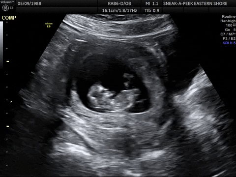 Uterus Trampoline [gif] | BabyCenter